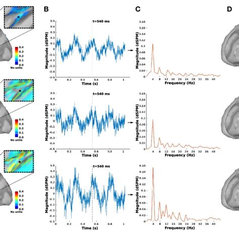 The Auditory Steady State Response Assr Map In Response To 4 Hz