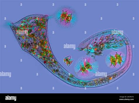 Desmids Polarised Light Micrograph Of Various Species Of Desmid Green