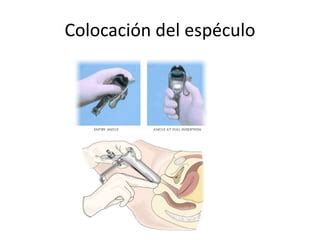 Semiologia En Ginecologia Y Obstetriciappt