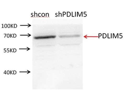Pdlim5 Rabbit Anti Human Mouse Rat Polyclonal Proteintech