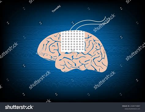 Brain Eeg Electrodes Over 163 Royalty Free Licensable Stock Vectors
