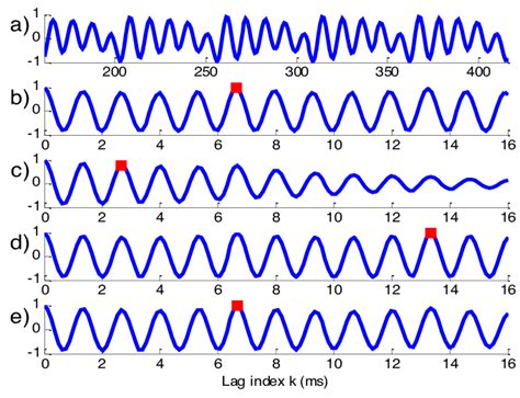 Waveform And Different Autocorrelation Functions Of A Synthetic Speech