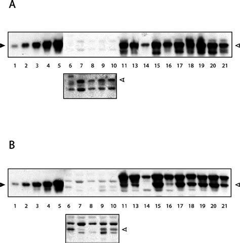 Western Blot Analysis Of Cyp2c9 And 2c19 Expression In Human Liver