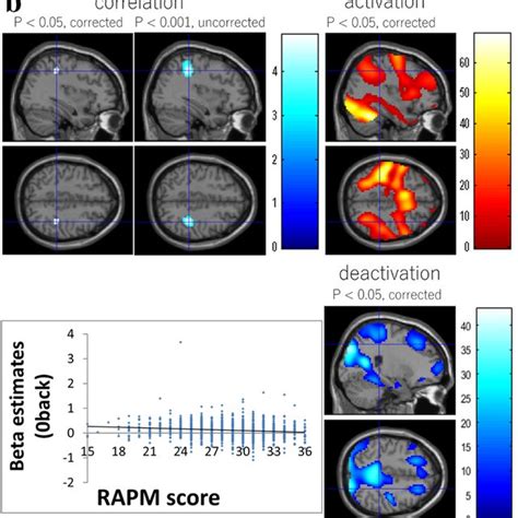 Associations Between Regional Neural Activity During A Simple Cognitive Download Scientific