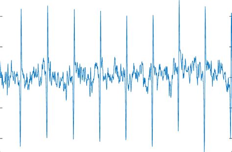 extracted fetal signal using fastica download scientific diagram