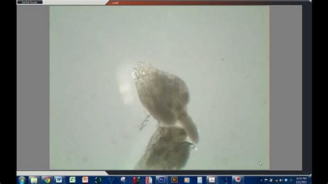 Drosophila Ovary Dissection Youtube