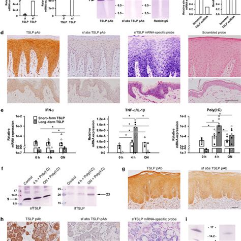 Antimicrobial Activity Of Short And Long Forms Of Thymic Stromal