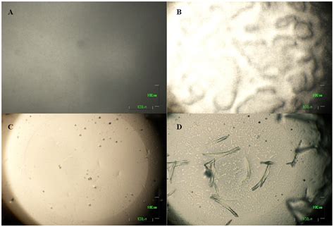 Time Course Of Microbatch Crystallization Protein 8 Mgml Mab04c
