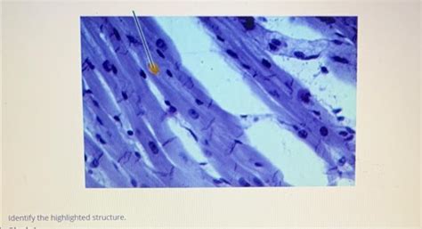 Solved Identify The Highlighted Structure Identify The