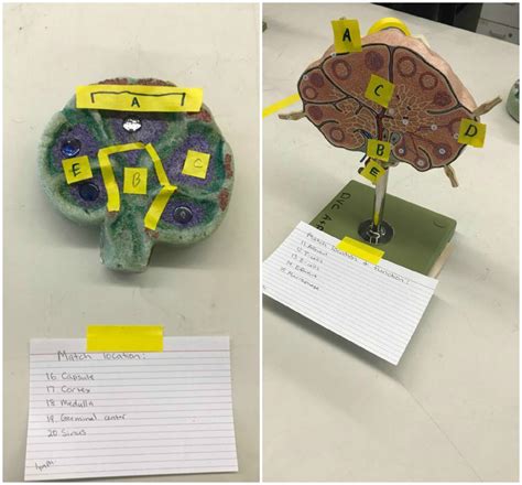 Lymph Node Diagram Quizlet