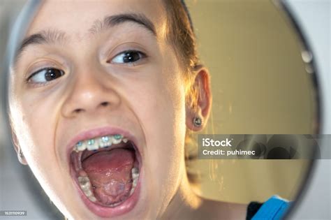 Caucasian Preteen Girl With Braces On Her Teeth Looking At The Mirror