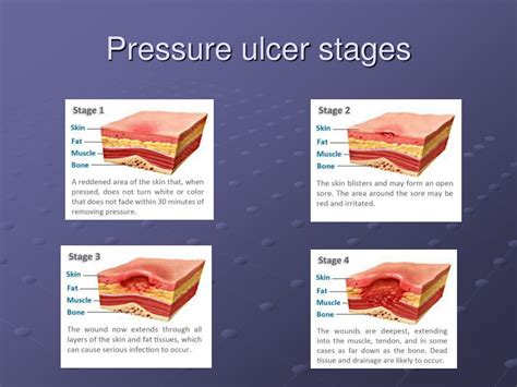 Ppt Comprehensive Guide To Wound Care And Healing Process Powerpoint