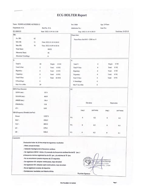 Ecg Holter Report Pdf