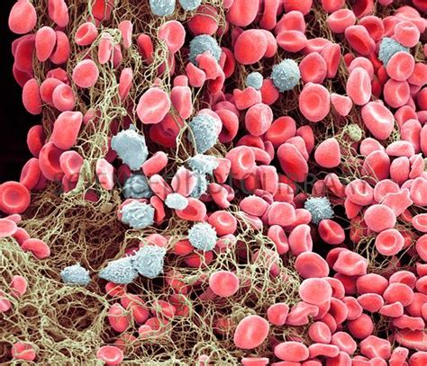 Bone Marrow Coloured Scanning Electron Micrograph Sem Of Bone Marrow From A Fractured Rib