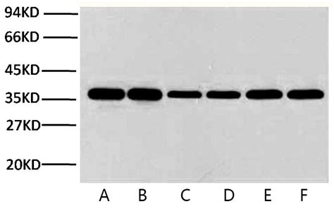 【β 肌動蛋白 β Actin 、gapdh Gapdh 和 β 微管蛋白 β Tubulin 抗體套組】abbkine貨號 Ktd101 En