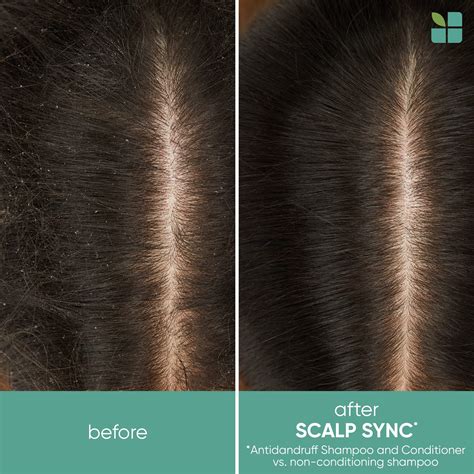 Scalp Sync Anti Dandruff Shampoo Targets Dandruff Controls The Appearance Of