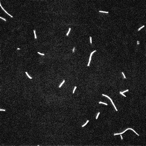 Actin Filament Detection Object Detection Dataset And Pre Trained Model By Actindynamics