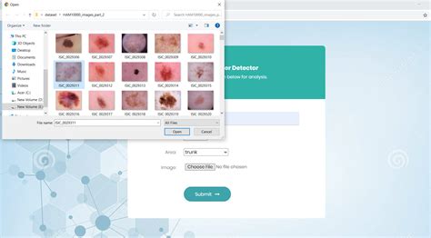 Detector Devpost Detector Devpost