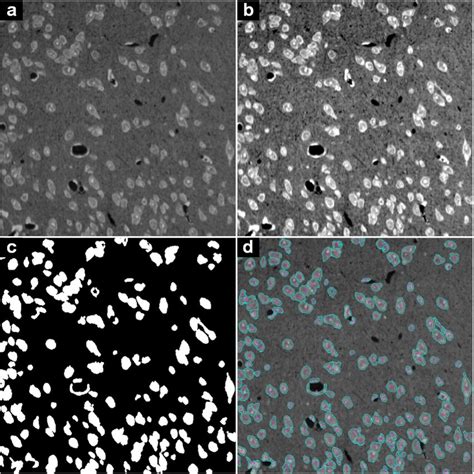 Cell Segmentation Result Of The Ns1 Image Of The Nsmost Dataset A