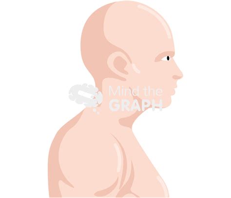 Man Forward Head Position Lateral