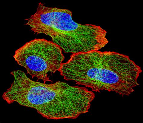 EZCell Cell Migration And Invasion Assays Caltag Medsystems