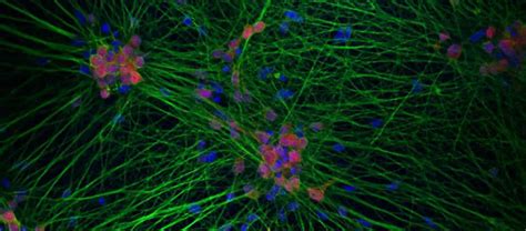 What Is An Induced Pluripotent Stem Cell Ipsc Rs Science