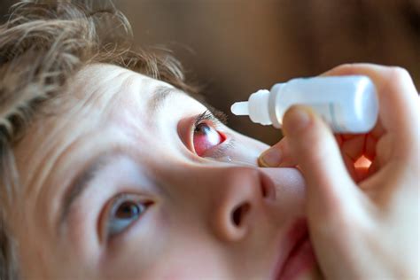 Uveitis Treatment In Turkey Free Online Consultation