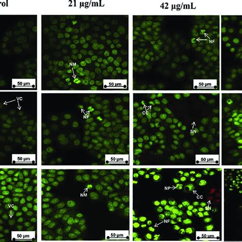 Morphological Characterizations Of Cells Undergo Apoptotic Cell Death Download Scientific
