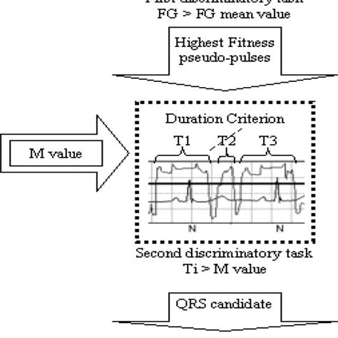 Beat Recognition And R Wave Detection Procedure Download Scientific
