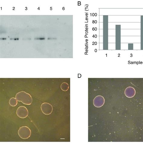 Different Expression Levels Of Lactobacillus Based Expression Vectors