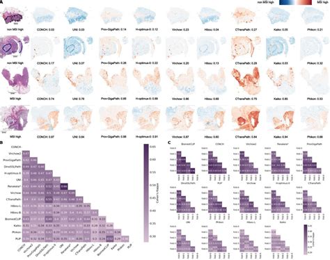 Figure From Benchmarking Foundation Models As Feature Extractors For Weakly Supervised