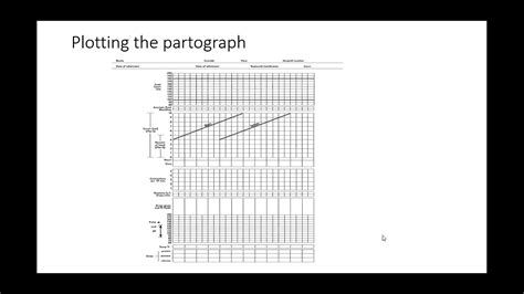 Partograph Technical Issues Youtube