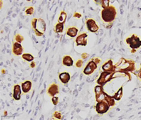 Delaunay Cluster Features In Qupath Quantification Image Analysis Image Sc Forum