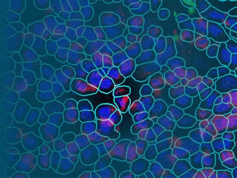 Cosmx™ Human Universal Cell Characterization Rna Panel