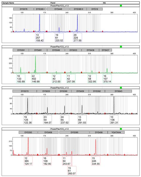 Application Of X Strs For Forensic Identification In Mixed Dna Profile A Case Report