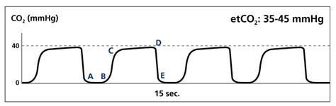Etco2 Monitoring Youre Doing The Right Thing