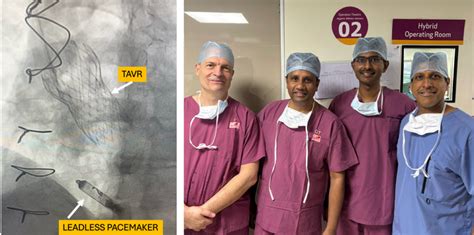 What Is A Leadless Pacemaker Benefits And Procedure Advanced Heart Rhythm Treatment