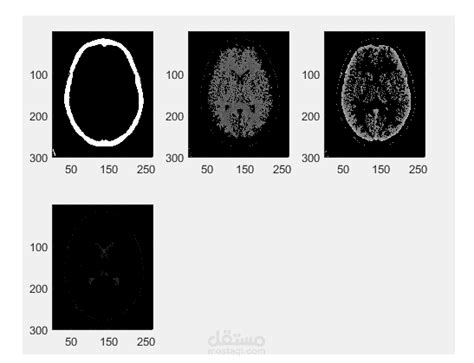 image segmentation matlab مستقل