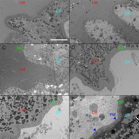 Absence Of A Detectable Peritrophic Matrix In The X Cheopis Midgut
