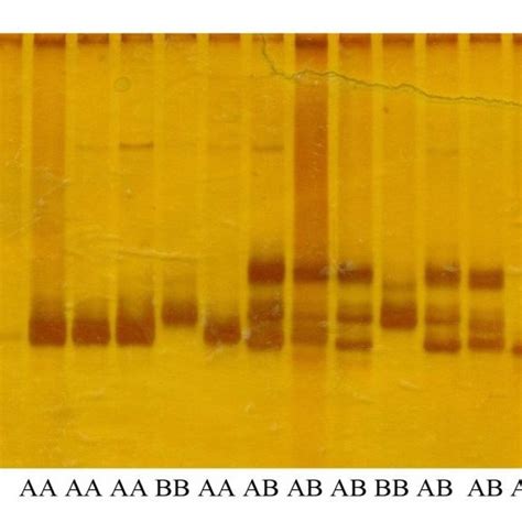An Example Of Genotyping Gel Alleles Right And Types Of Genotypes Download Scientific