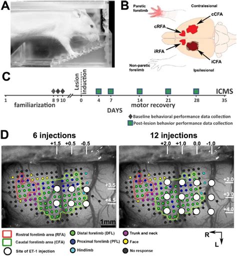 The Effect Of Lesion Size On The Organization Of The Ipsilesional And