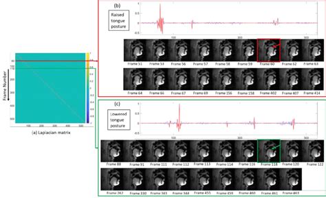 Visualizing The Graph Laplacian Matrix For The Speaking Task Of