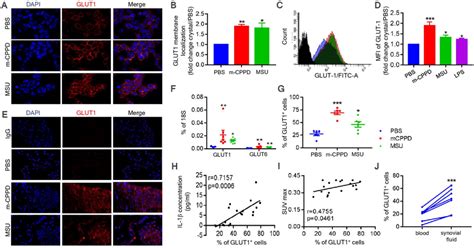 Msu And M Cppd Crystals Increase Glut1 Expression At The Cell Plasma Download Scientific Msu And M Cppd Crystals Increase Glut1 Expression At The Cell Plasma Download Scientific