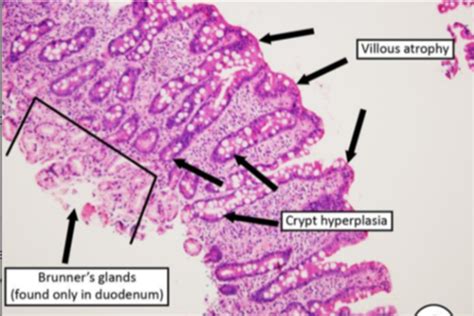 Uworld 10 Flashcards Quizlet