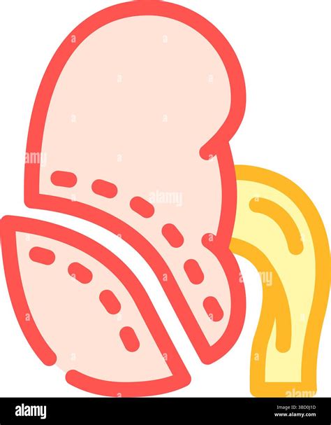 Nephrectomy Urology Color Icon Vector Illustration Stock Vector Image