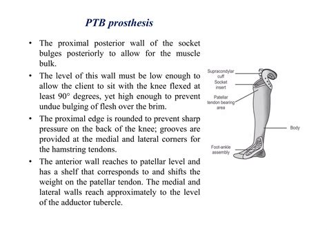 Prosthesis Pdf