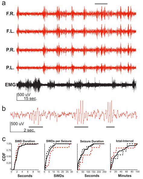 Cortical Tonic Inhibition Gates The Expression Of Spike And Wave