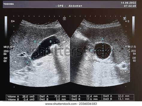 1 056 Imágenes Fotos De Stock Objetos En 3d Y Vectores Sobre Sonografista Shutterstock
