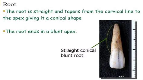 Maxillary Central Incisor Oral Anatomy Pptx