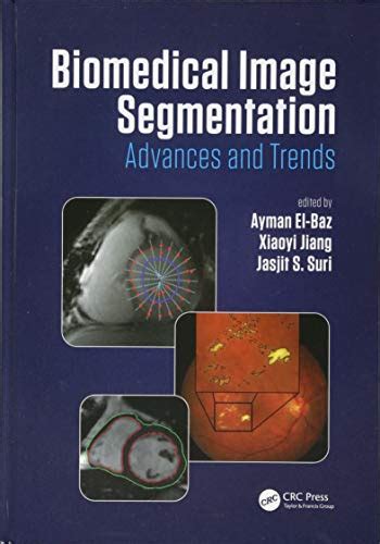 Biomedical Image Segmentation Advances And Trends Medicine Health Science